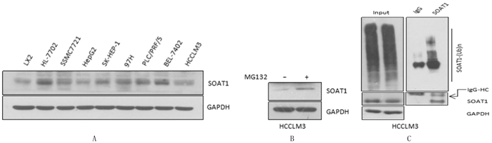 去泛素化酶OTUD3调控胆固醇酯化酶SOAT1蛋白稳定性的机制
