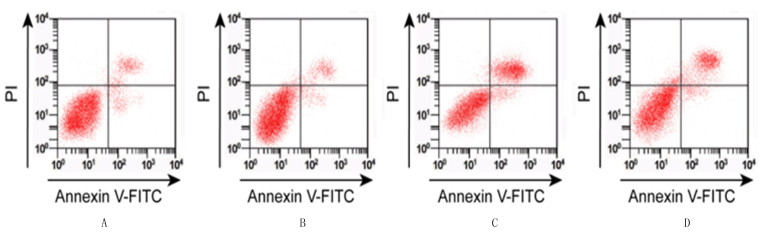 miR-29a对MPP + 诱导PC12细胞凋亡影响及机制