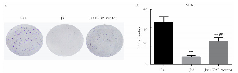 下调JMJD2B表达对卵巢癌细胞增殖的影响