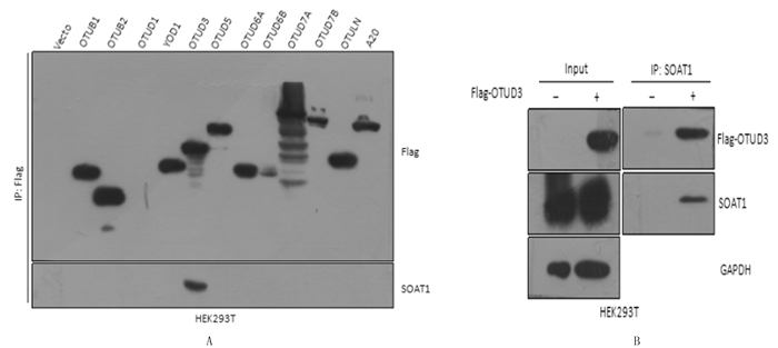 去泛素化酶OTUD3调控胆固醇酯化酶SOAT1蛋白稳定性的机制