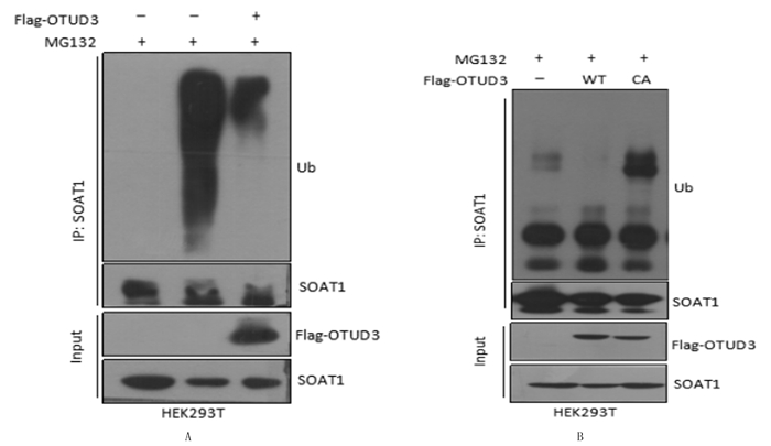 去泛素化酶OTUD3调控胆固醇酯化酶SOAT1蛋白稳定性的机制