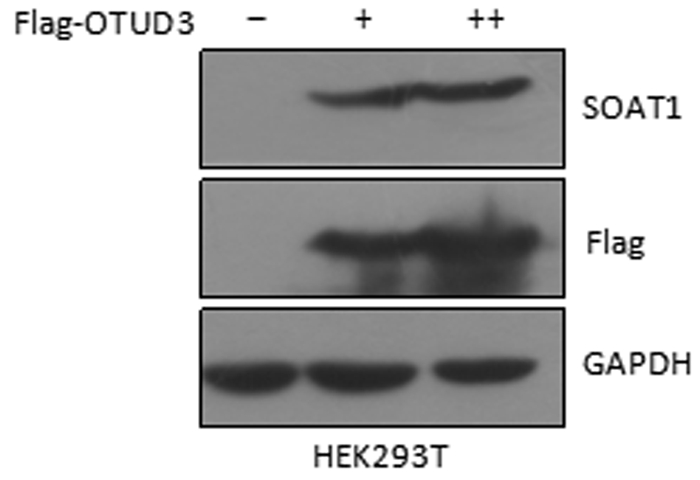 去泛素化酶OTUD3调控胆固醇酯化酶SOAT1蛋白稳定性的机制