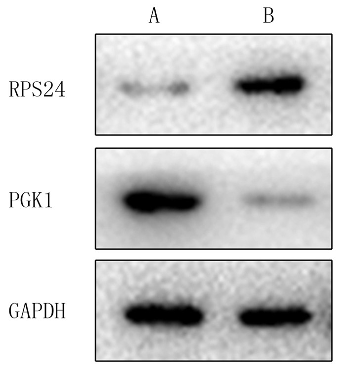 核糖体蛋白S24对人颈动脉粥样硬化的影响及机制