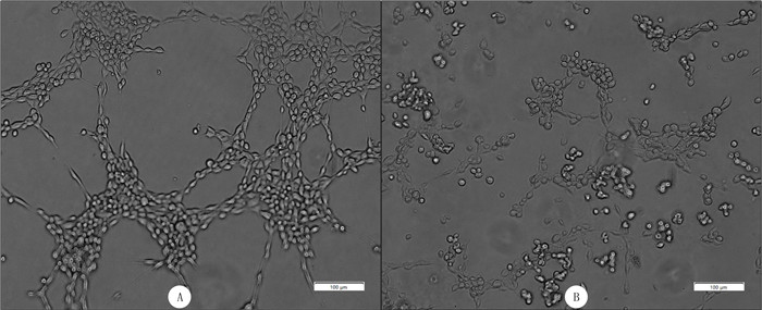 核糖体蛋白S24对人颈动脉粥样硬化的影响及机制