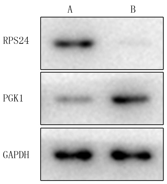 核糖体蛋白S24对人颈动脉粥样硬化的影响及机制