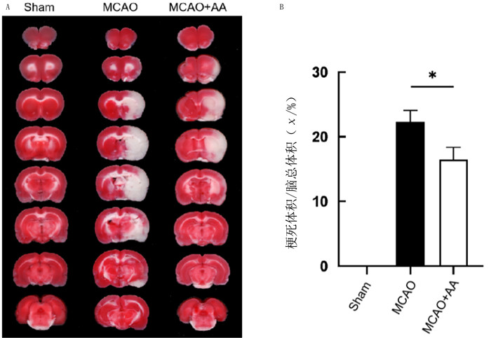 花生四烯酸对大鼠缺血性脑损伤的作用及机制
